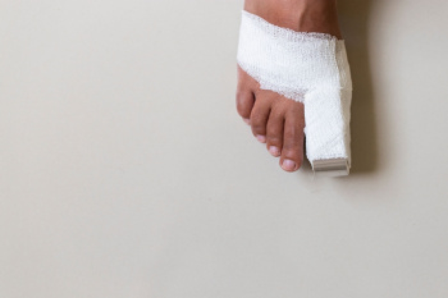 Causes and Treatment of a Broken Toe